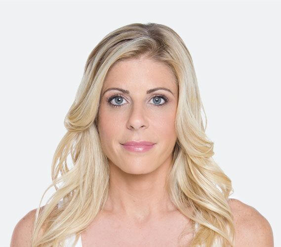 Antes y después del lifting facial líquido: Cómo redefinir tu look