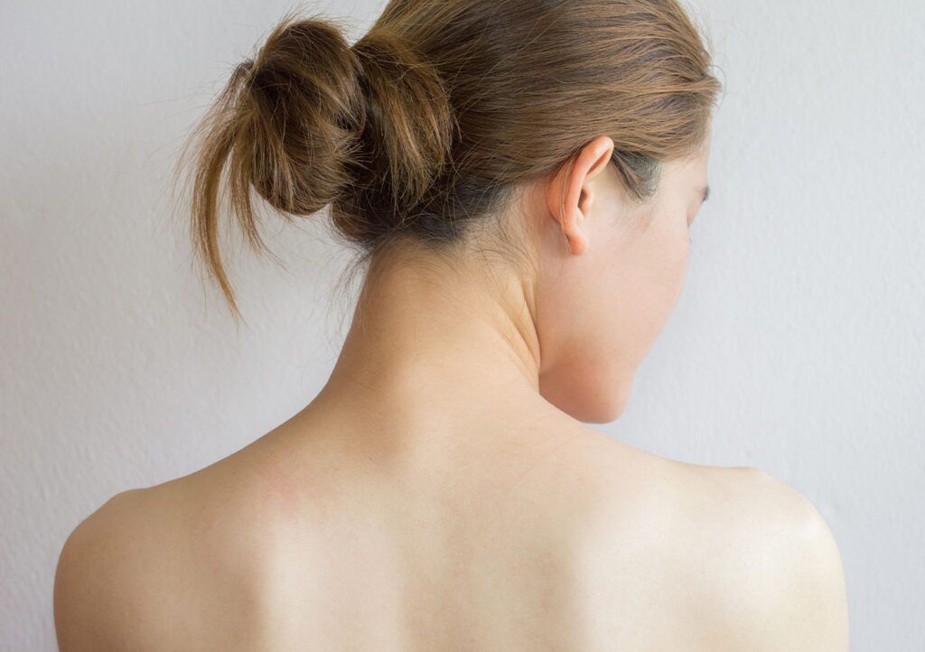 Bótox para el trapecio: Pros y contras de la tendencia de"Trap Tox"